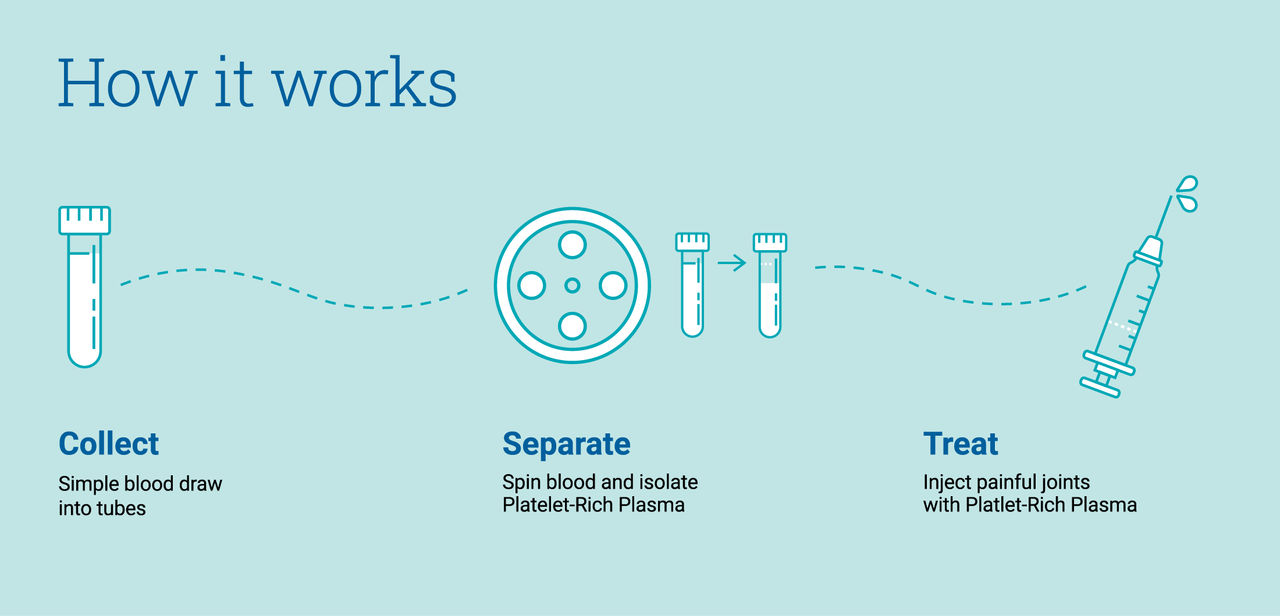 Platelet-rich Plasma (PRP) Injections | Mass General Brigham